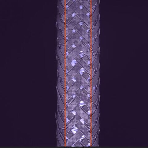 Braiding Defect Inspection - Camera-Based Quality Control | Taymer ...